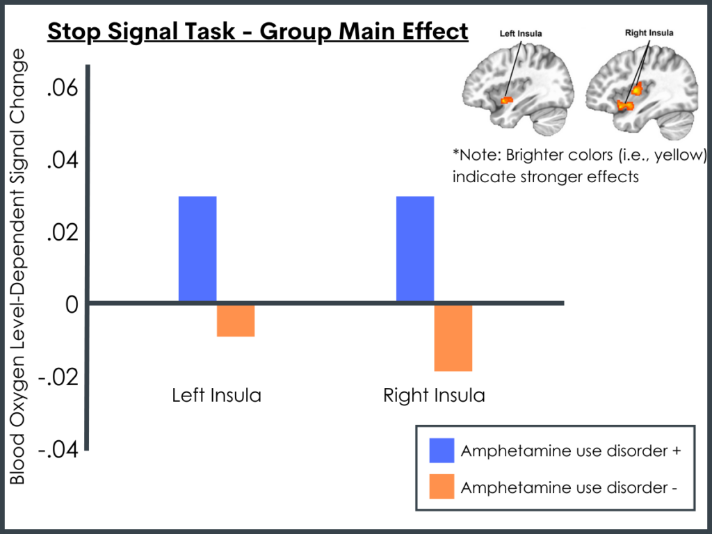 Brain markers of impulsivity in amphetamine use disorder – Recovery ...